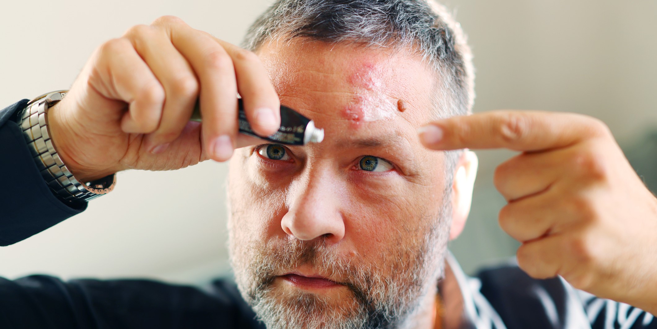 Fuoco di Sant'Antonio: Cibi consigliati e da evitare | Educazione ...